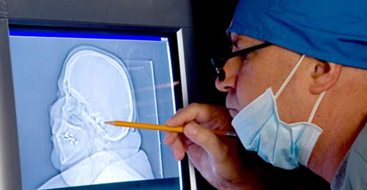 Minimally Invasive Endoscopic Skull Base Surgery | ENT Doctor ...